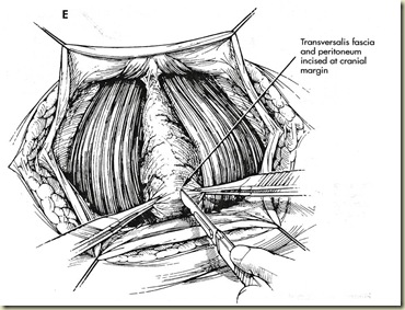 INFORMASI REPRODUKSI: TEHNIK LAPAROTOMI